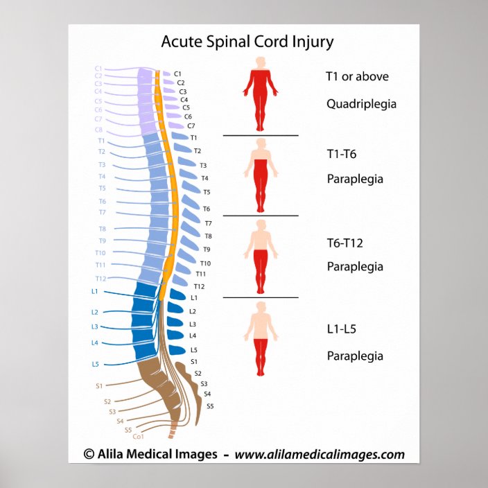 Spinal cord injury levels, labelled diagram. poster | Zazzle.ca