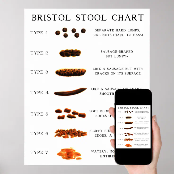 Stool Chart | Zazzle